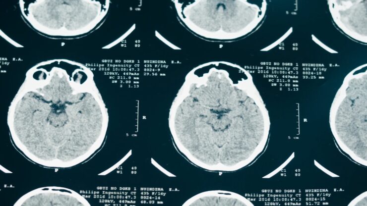 What Falls Under the Category of Personal Injury Cases? Fighting for ...